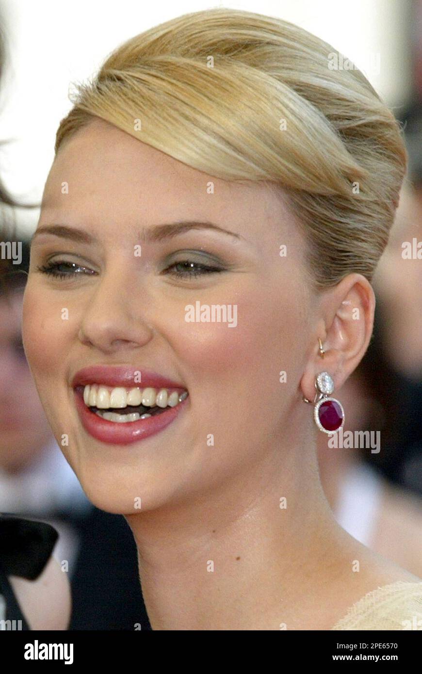 Scarlett Johansson Teeth Before And After