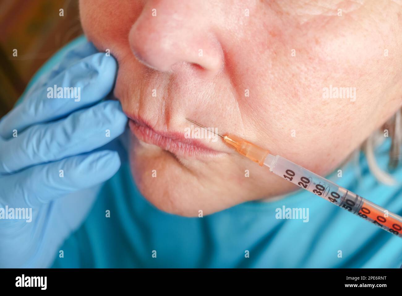 Older woman injected in lips Hyaluronic acid, Woman in beauty salon ...