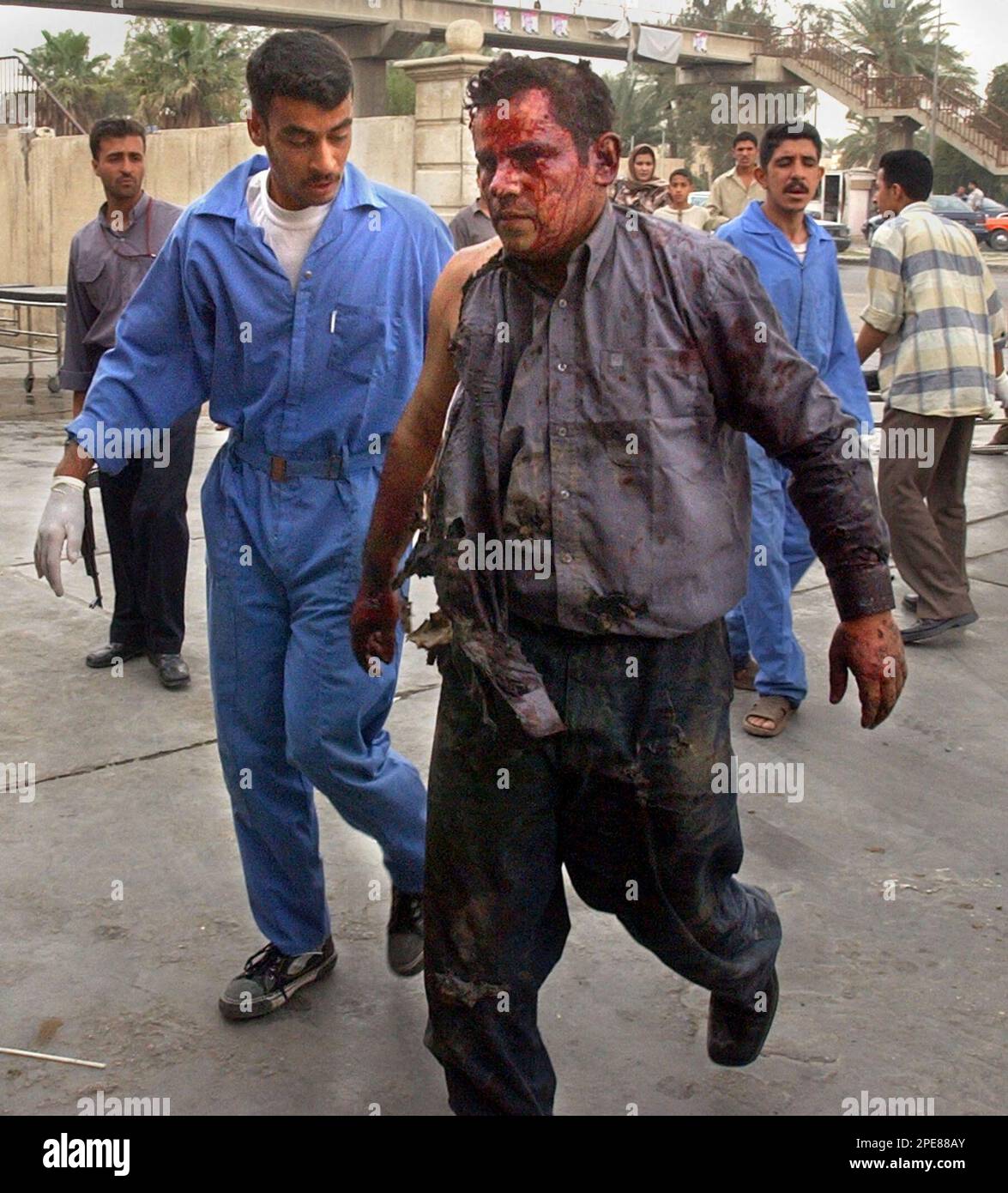 A wounded Iraqi man arrives at Yarmouk Hospital after a pair of car ...