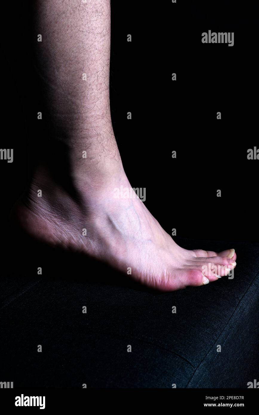 man foot with long nails Stock Photo - Alamy