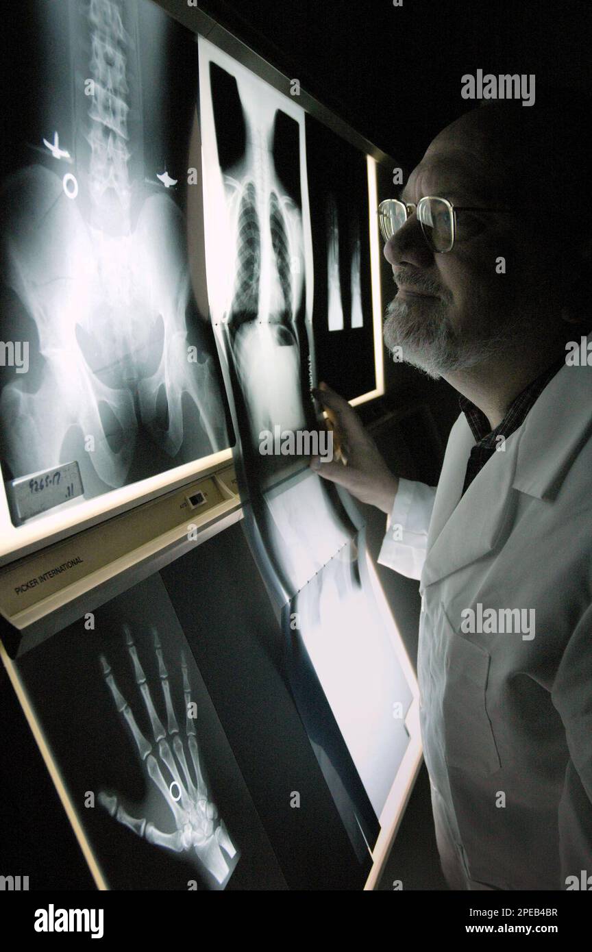 Kodak research associate Phillip Bunch looks over the new X-ray film he ...