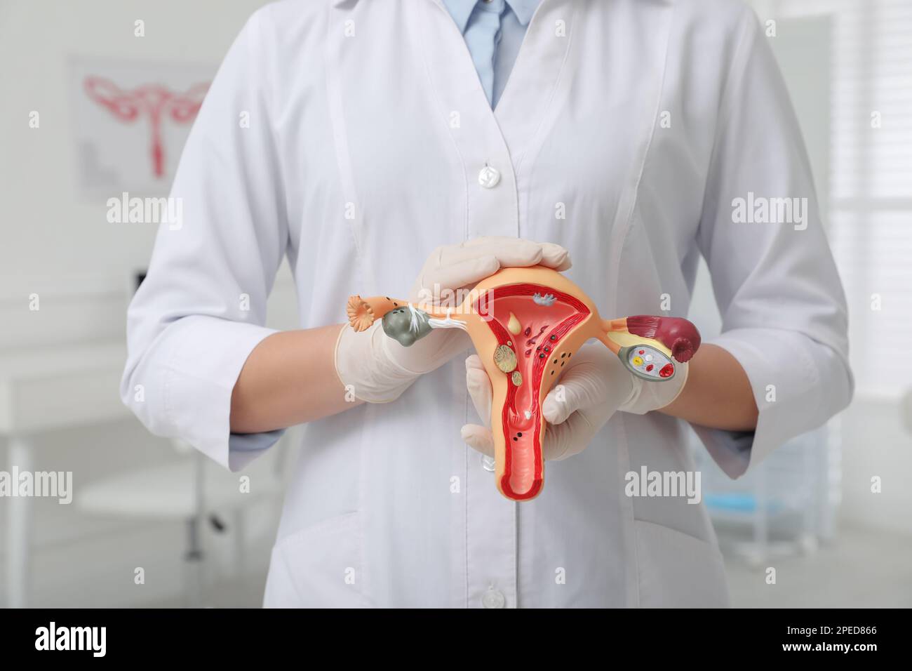 Gynecologist demonstrating model of female reproductive system in ...