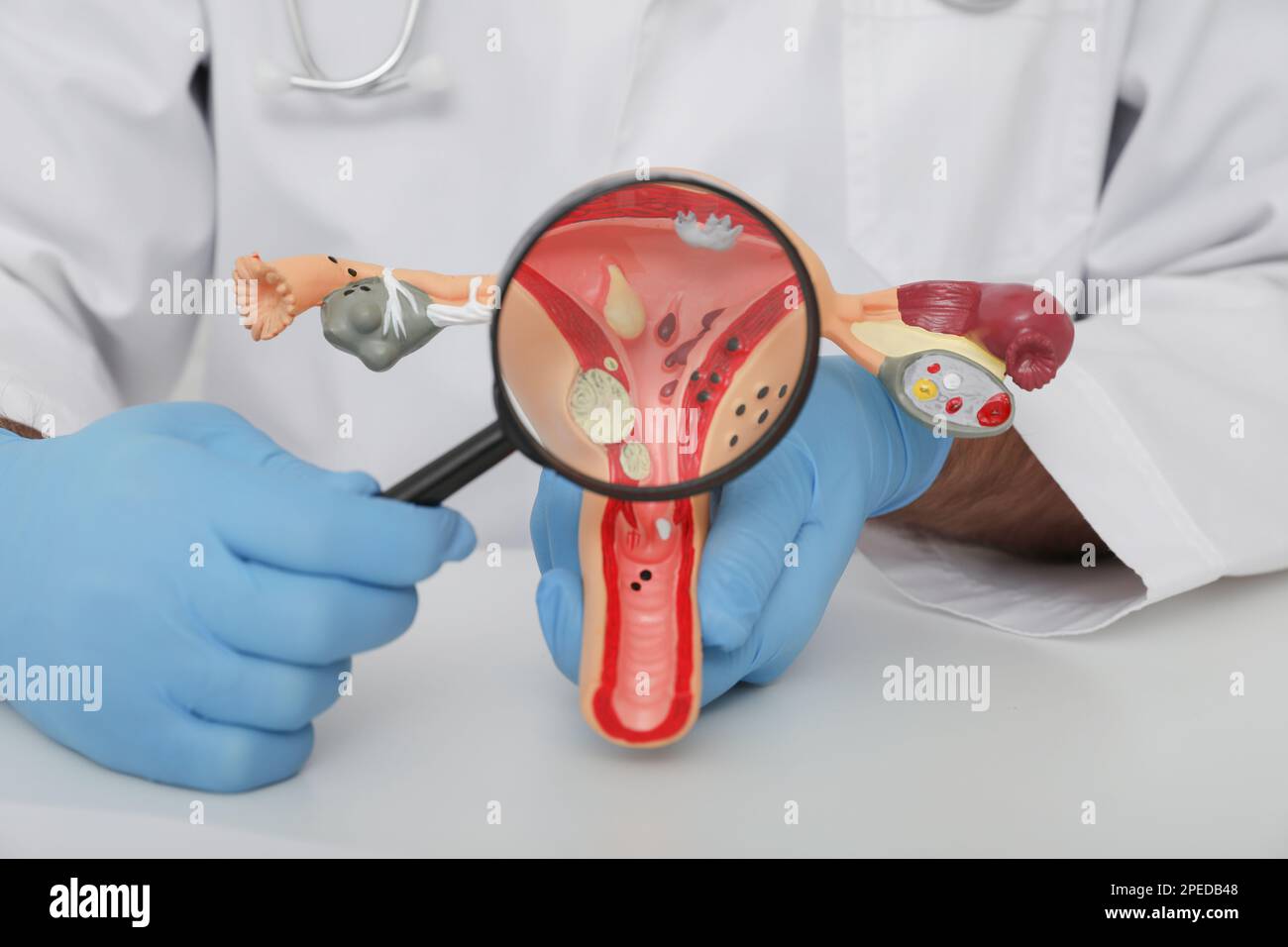 Gynecologist demonstrating model of female reproductive system at table ...