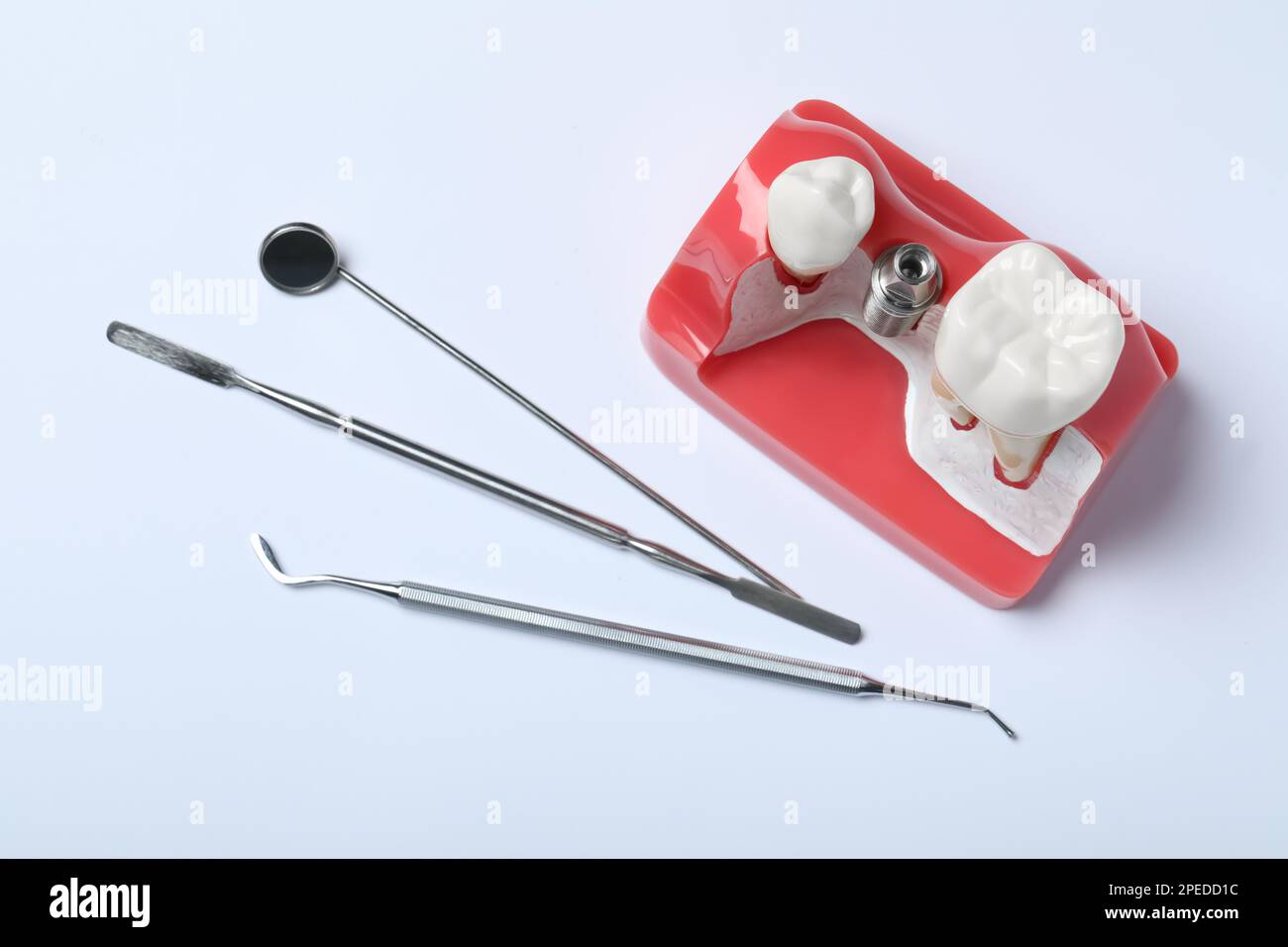 Educational model of gum with post for dental implant between teeth and ...