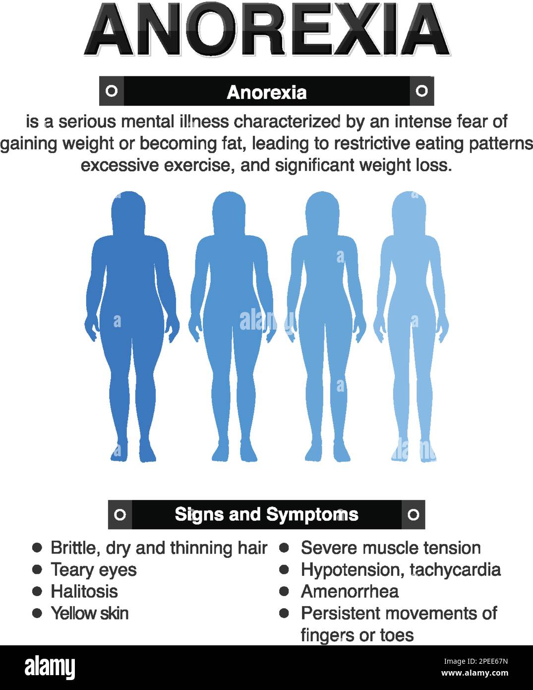 Anorexia (Anorexia) and Its Effects on the Body illustration Stock ...