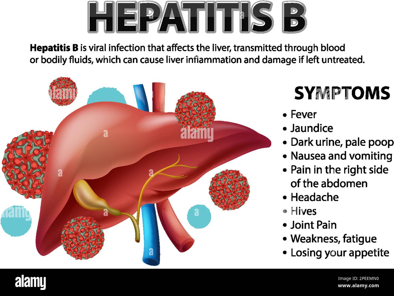 Symptoms of Hepatistis B illustration Stock Vector Image & Art - Alamy