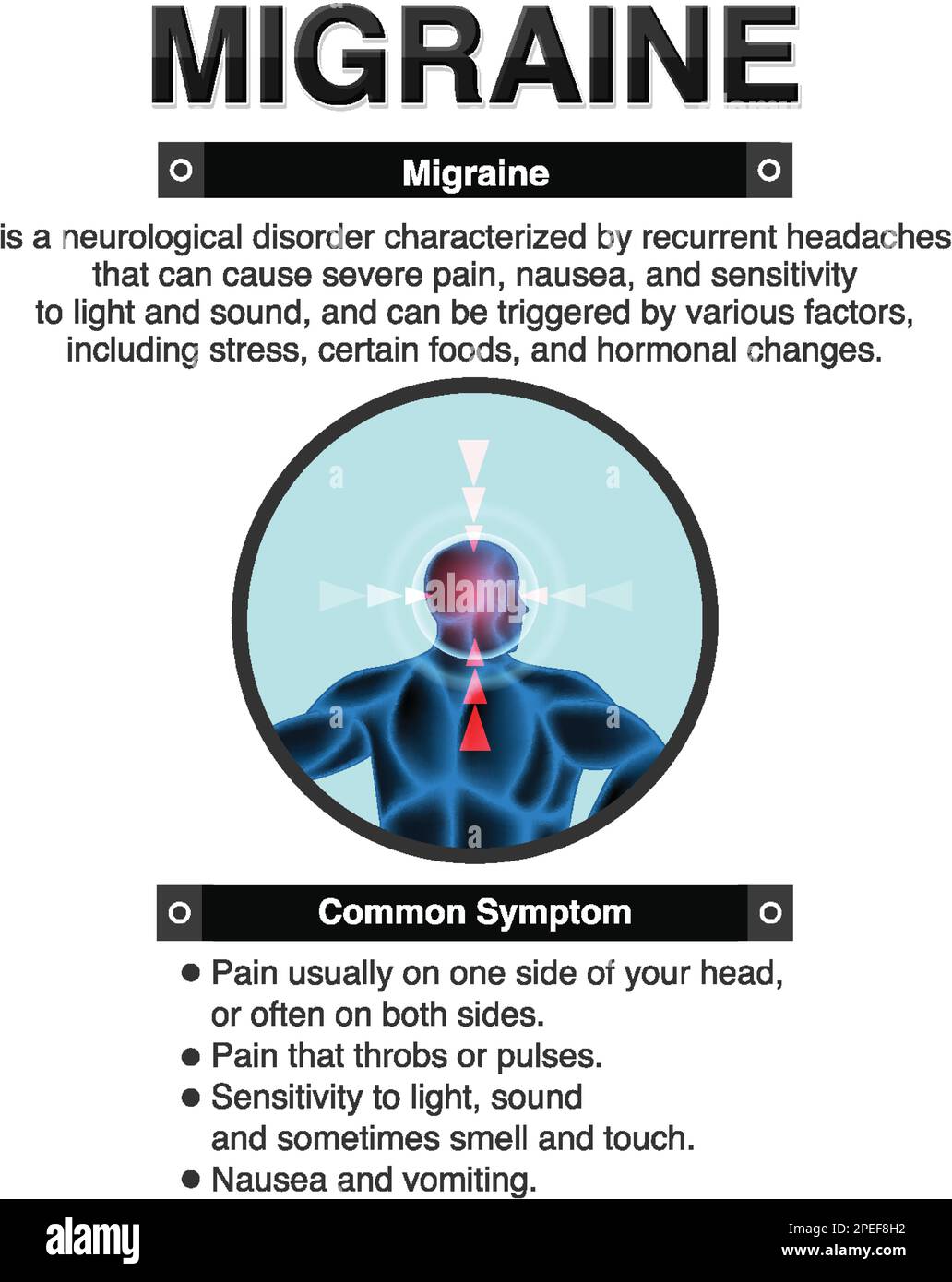 Informative poster of Migraine illustration Stock Vector Image & Art ...