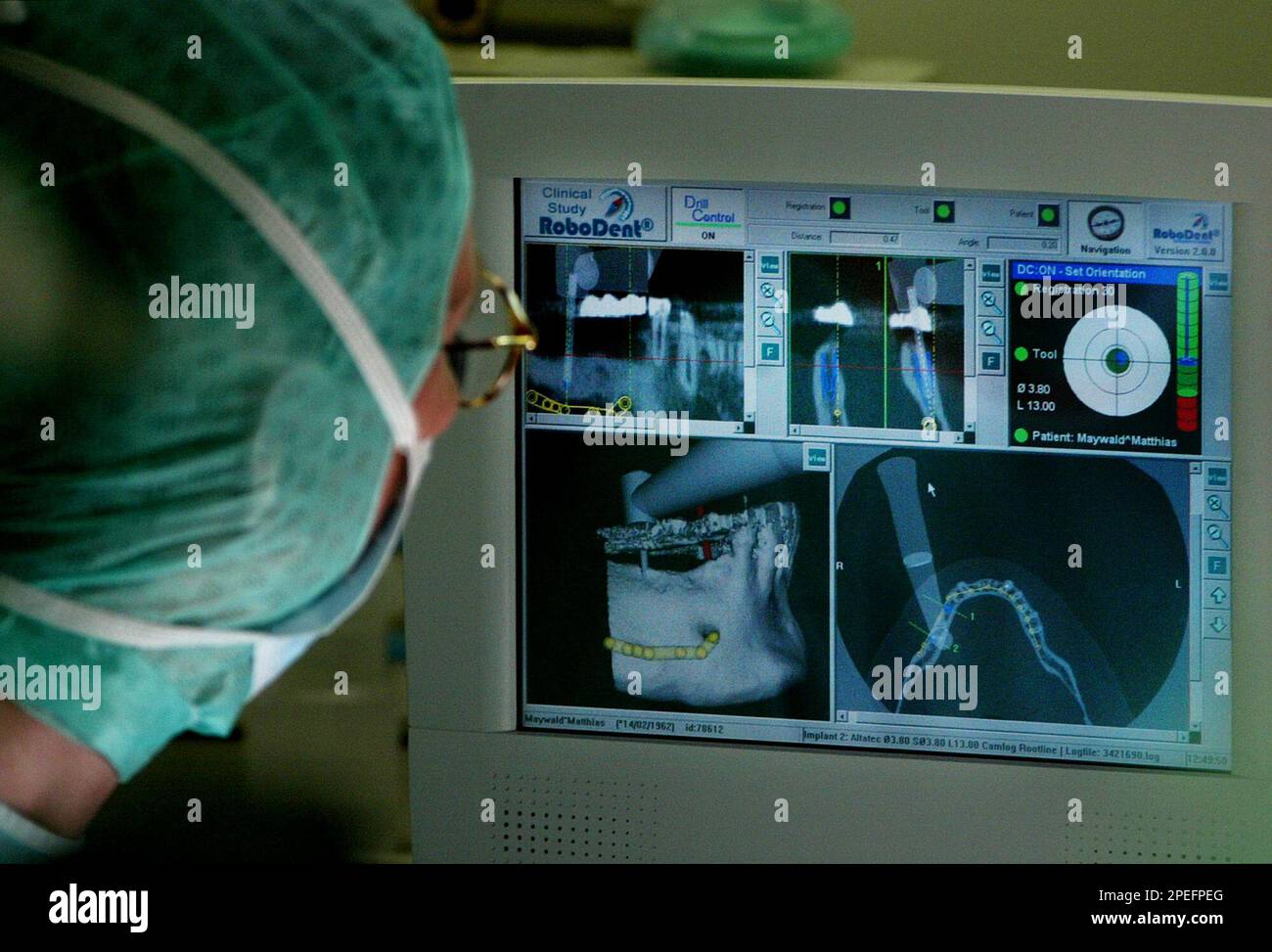 A dental surgeon looks at the screen of the new "Navigated Control ...