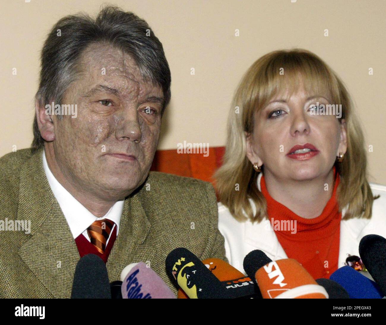 Viktor Yushchenko Before And After Poisoning