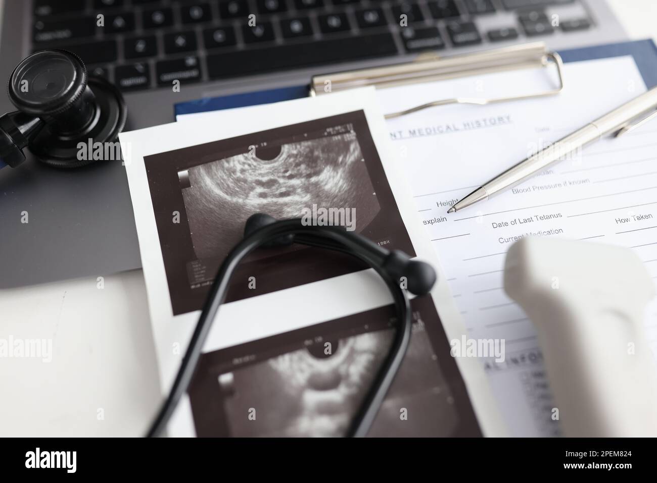 Modern Ultrasound Device With Sensor And Ultrasound Of Uterus Stock