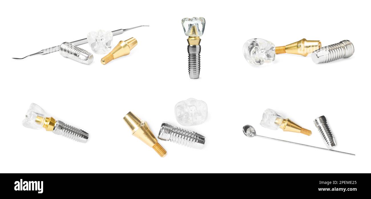 Educational models of dental implants and medical tools on white ...