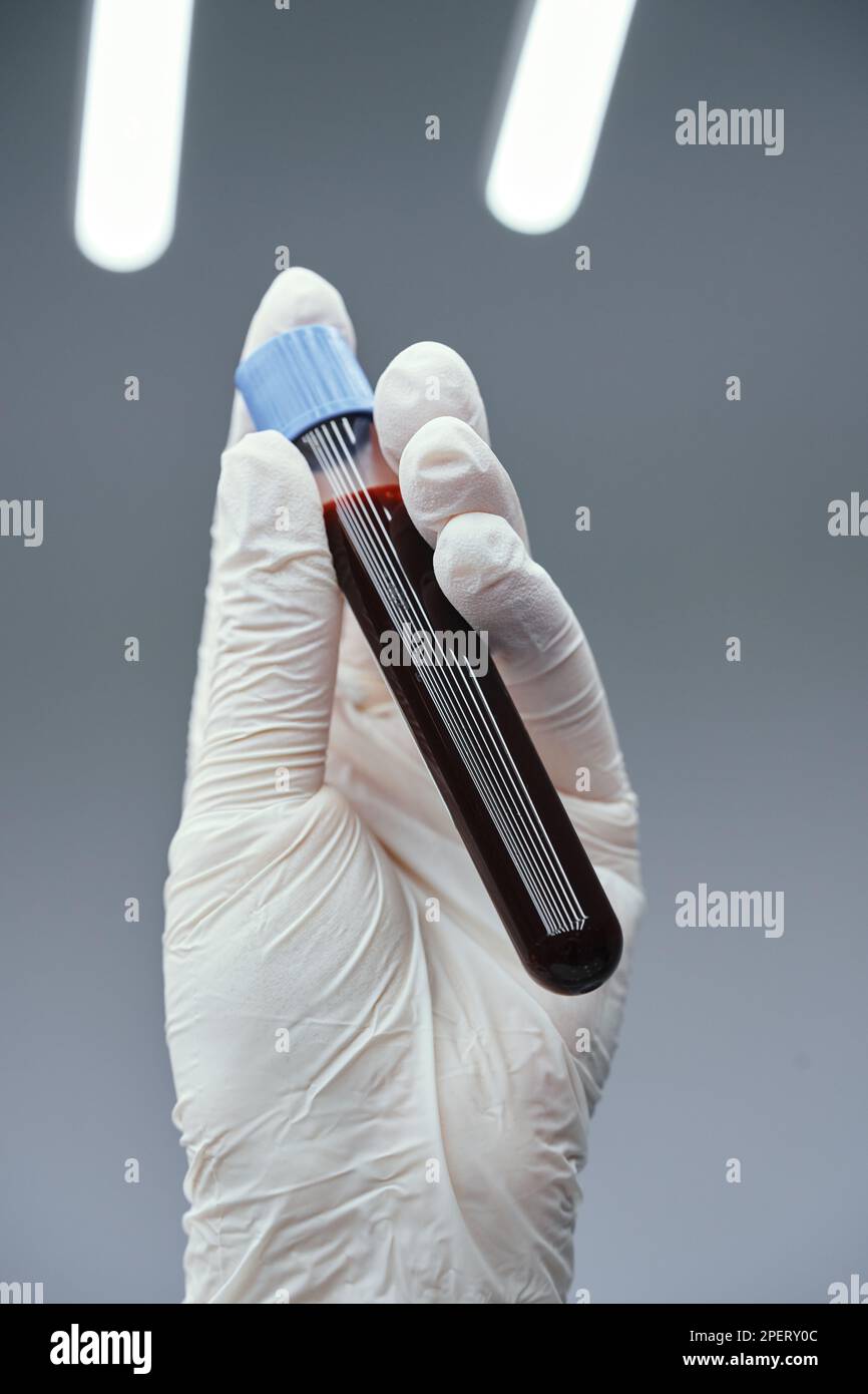 Arterial blood sample hi-res stock photography and images - Alamy