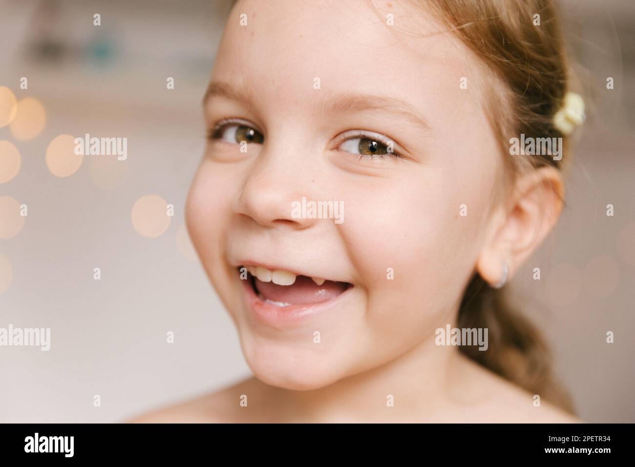 Tooth loss hi-res stock photography and images - Alamy