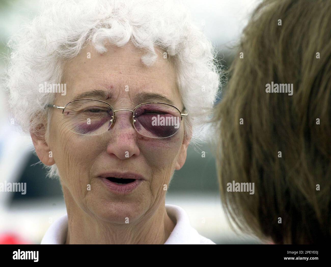 Bernice Wolcott's injuries can be seen as she talks with a neighbor ...