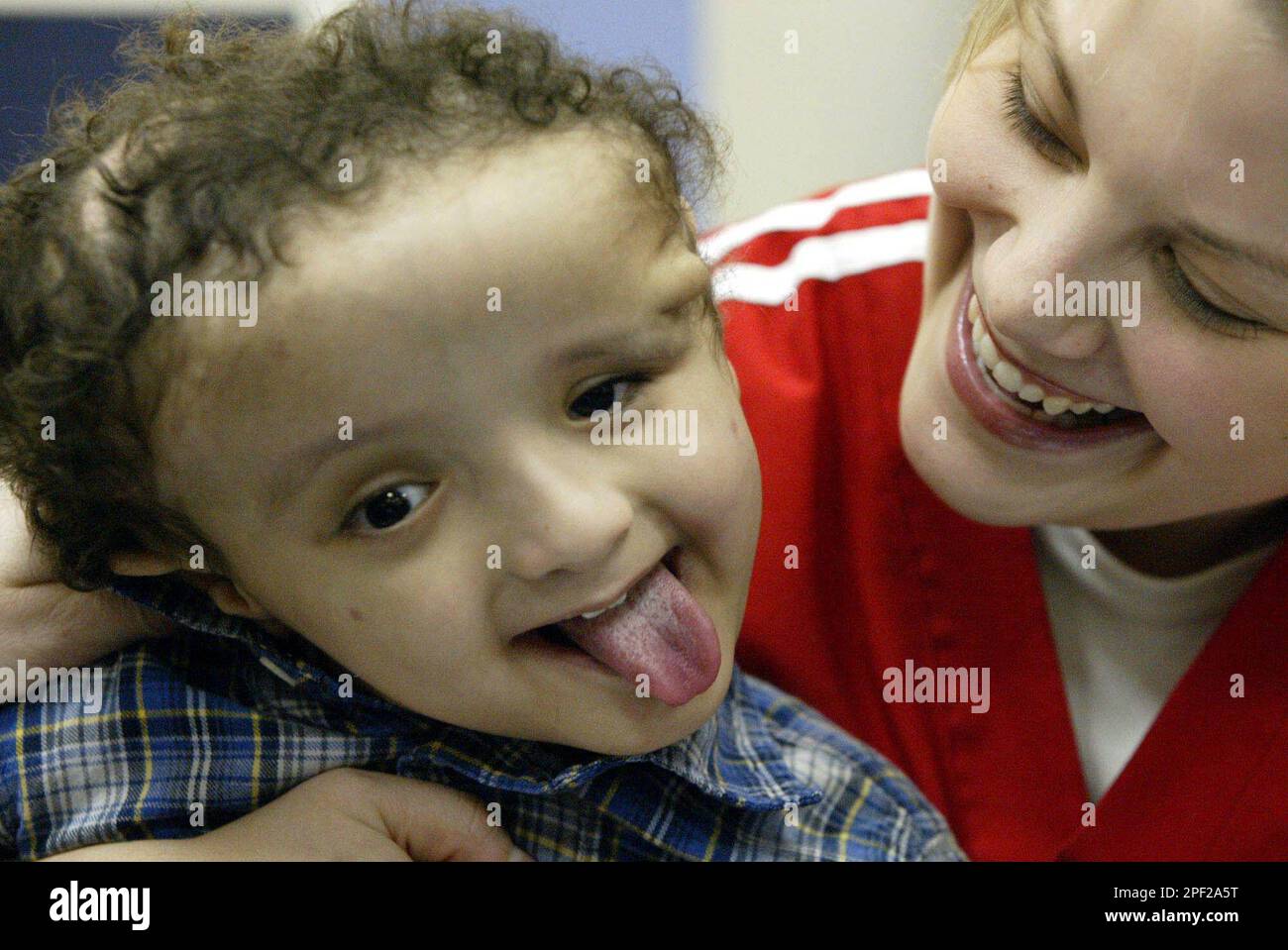 Two-year-old Ahmed Ibrahim sticks out his tongue during a therapy ...