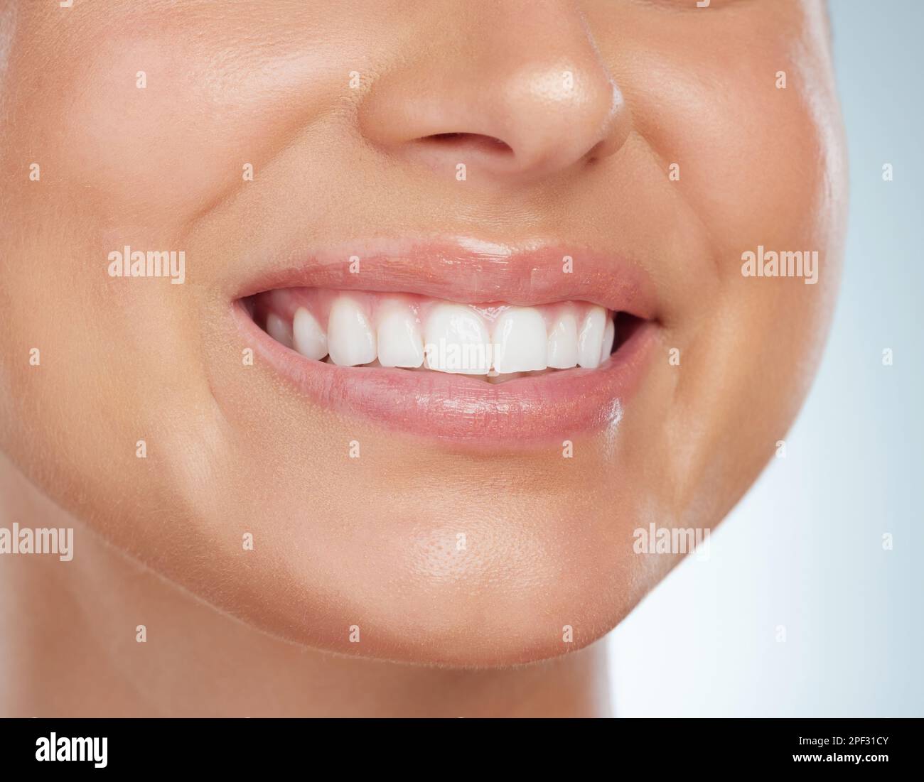 Closeup of unknown woman smiling with white teeth after a whitening ...