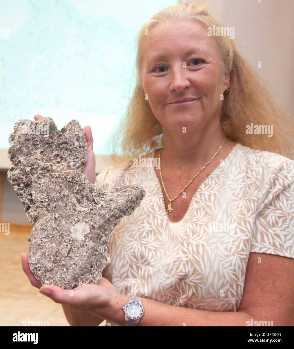 Dr. Shelly Williams displays Thursday, Aug. 14, 2003 in Omaha, Neb., a ...