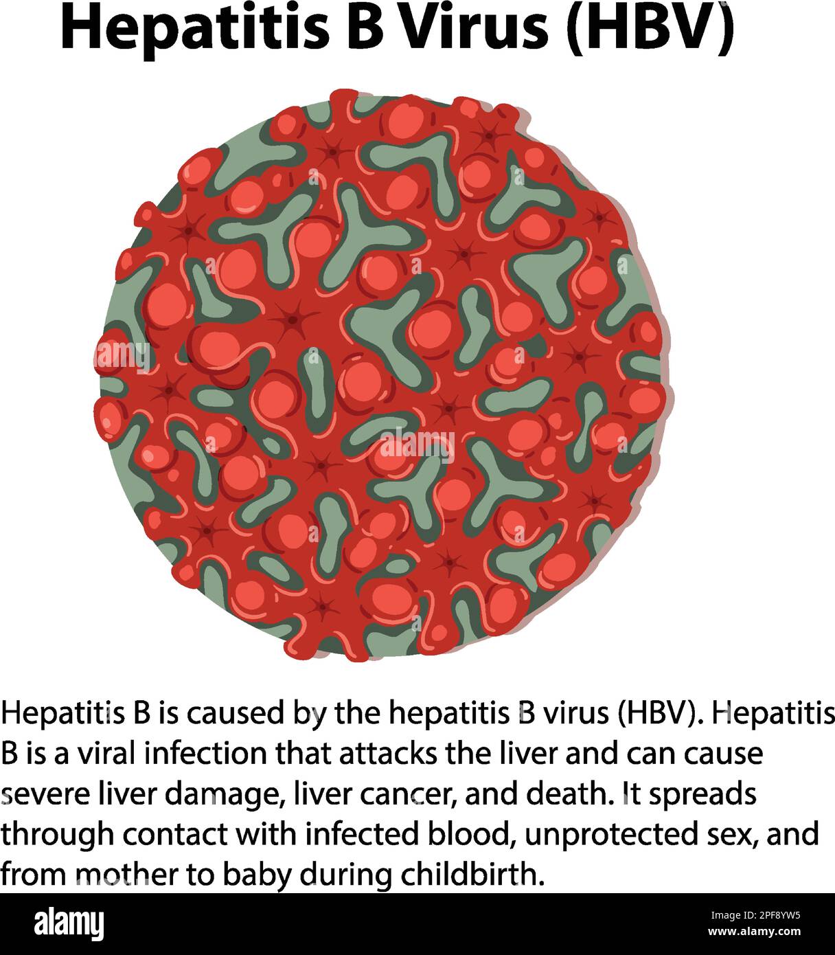 Hepatitis B Virus (HBV) with explanation illustration Stock Vector ...