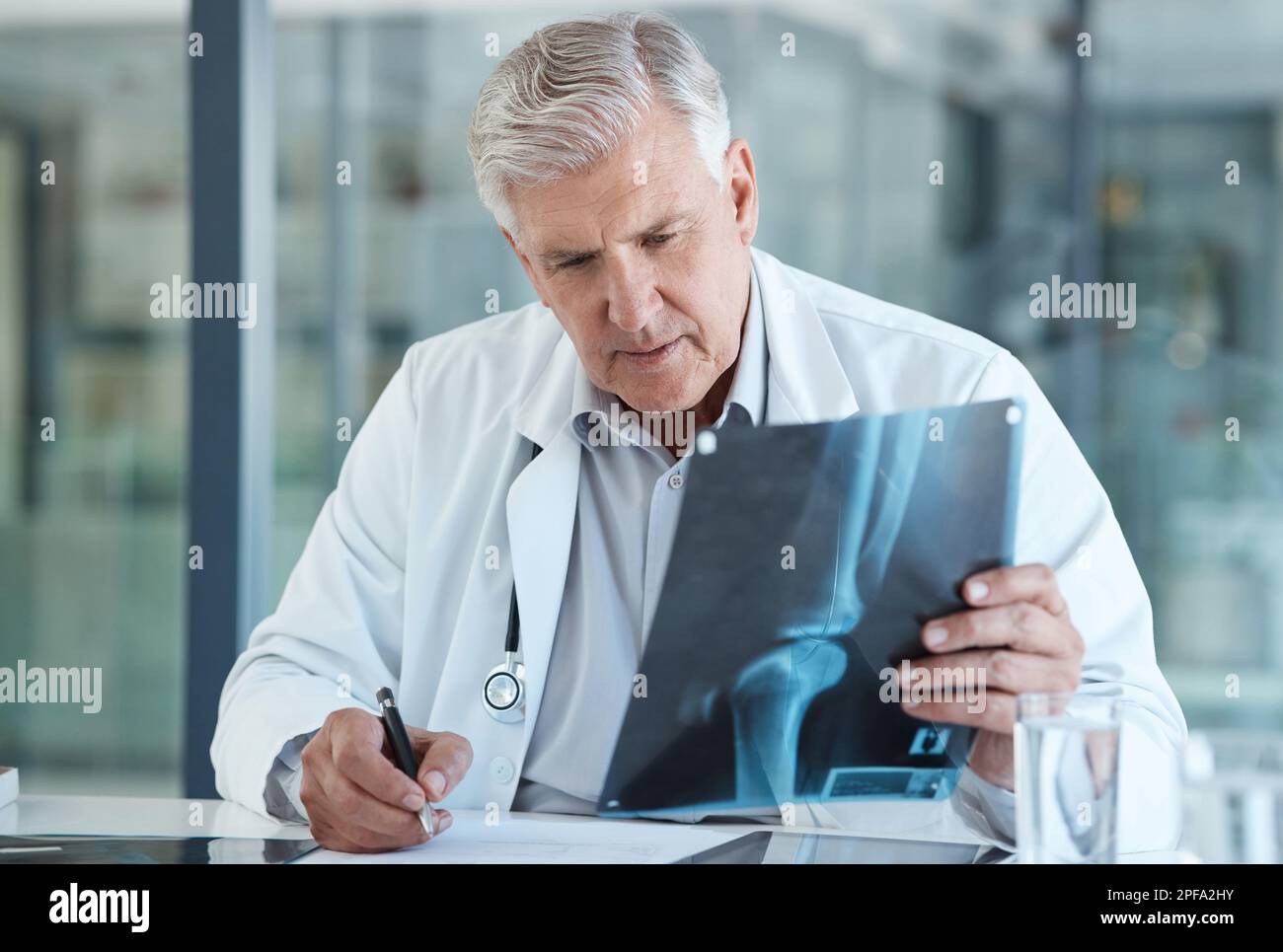 The bone has broken in two places. a male doctor reviewing a patients x ...