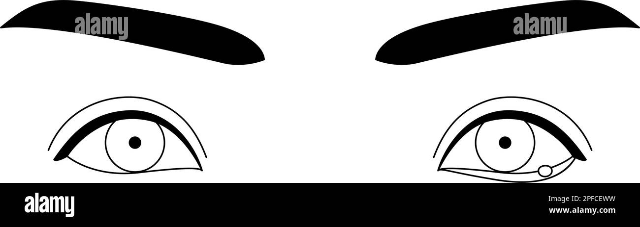 Medical Clipart, Line Drawing Illustration of Eye Disease and Sty ...