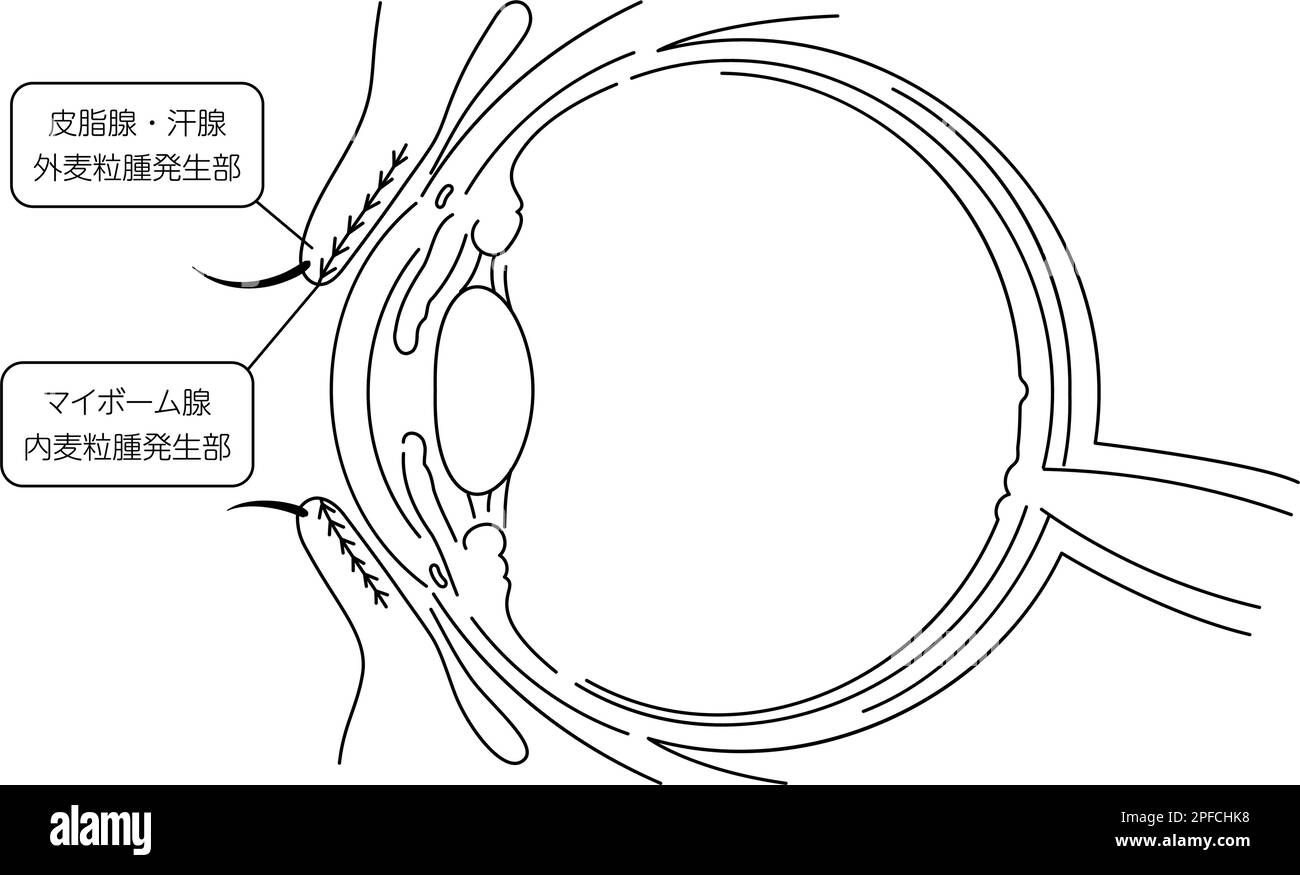 Medical illustration, Anatomical drawing of the site of origin of eye ...