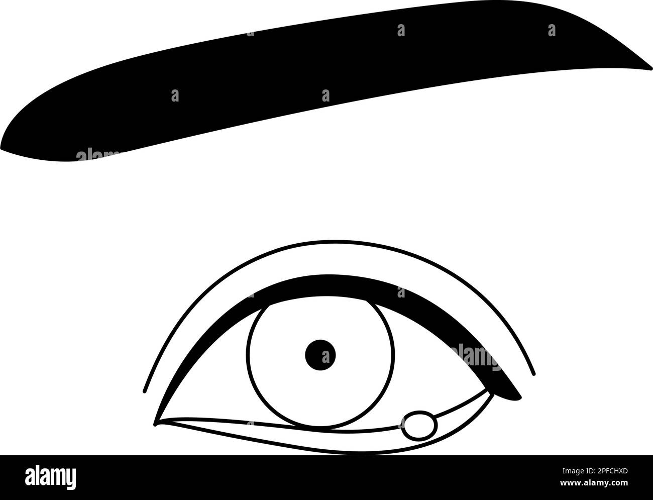 Medical Clipart, Line Drawing Illustration of Eye Disease and Sty ...
