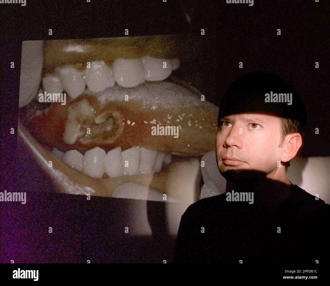 Dr. Mark Nichols poses in front of an image showing a patitent ...