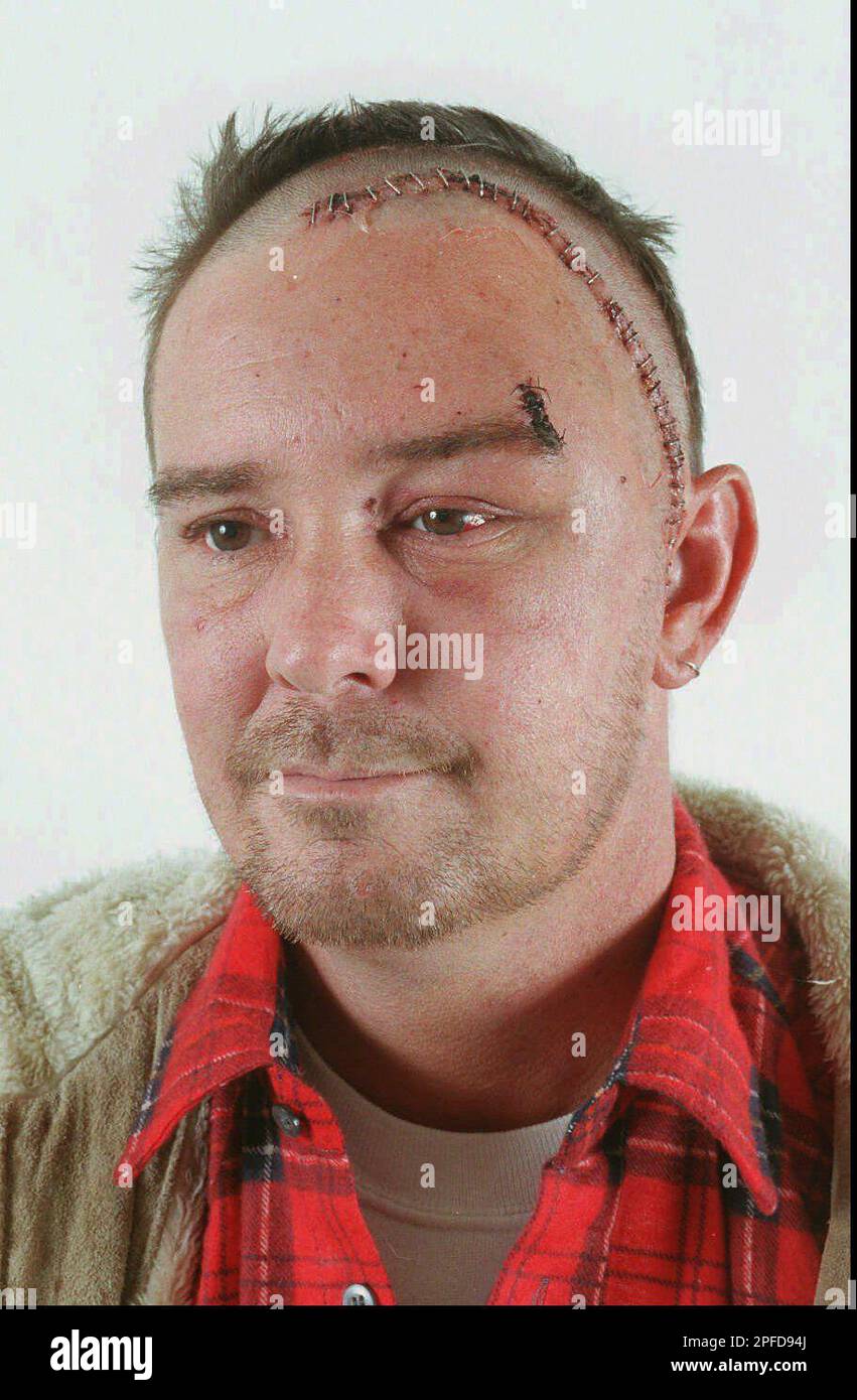 Timothy Fulcher, shown Jan. 4, 1999, in Charleston, S.C., had a bullet ...