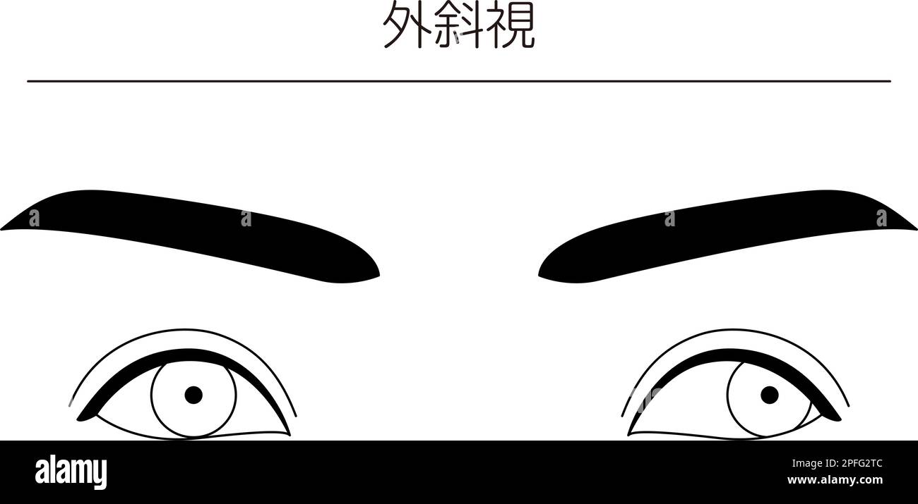 Medical illustrations, diagrammatic line drawings of eye diseases ...