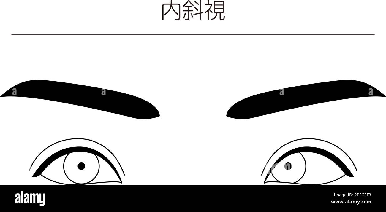 Medical illustrations, diagrammatic line drawings of eye diseases ...