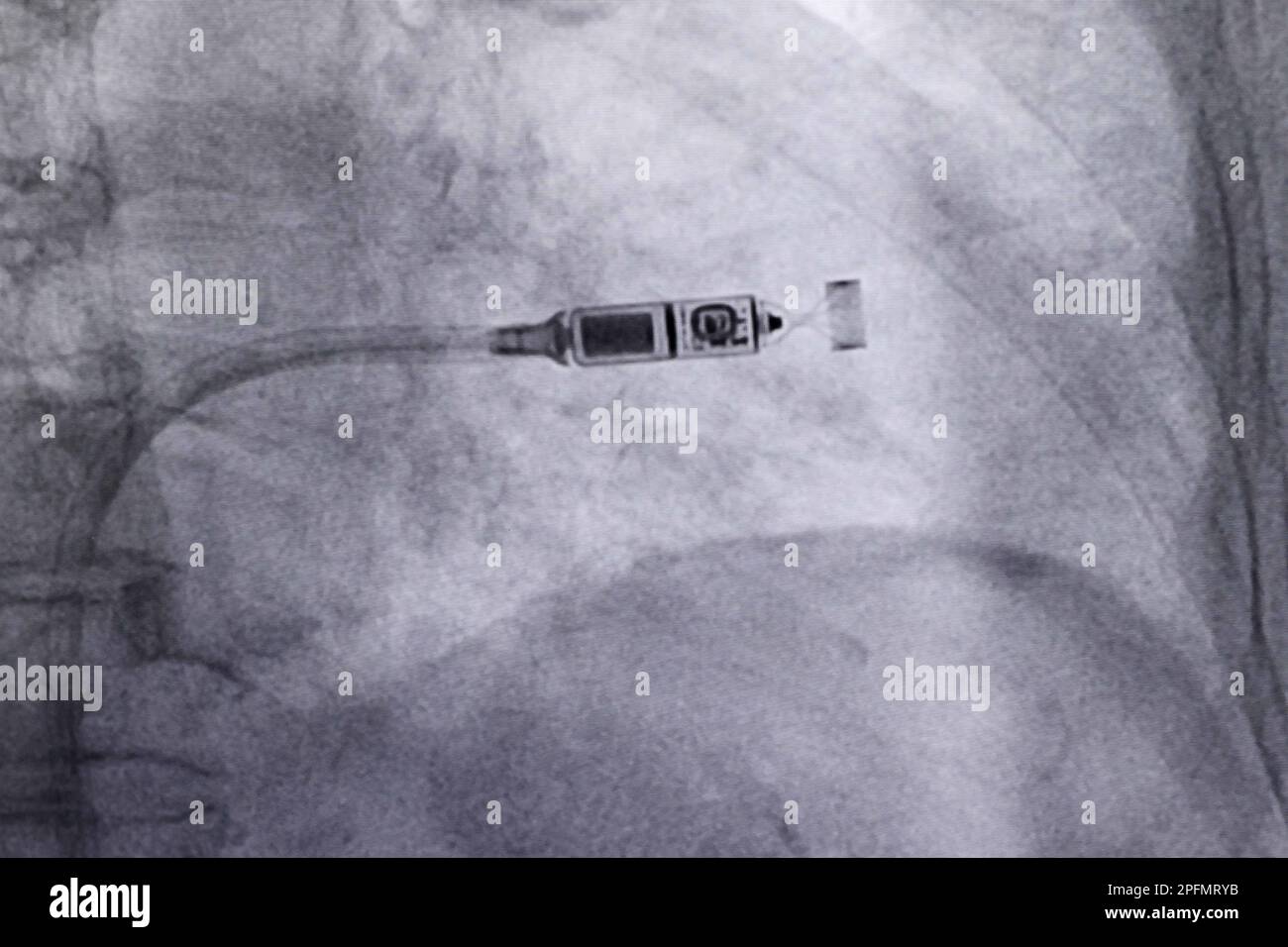 LIUZHOU, CHINA - MARCH 9, 2023 - Photo taken on March 9, 2023 shows a ...