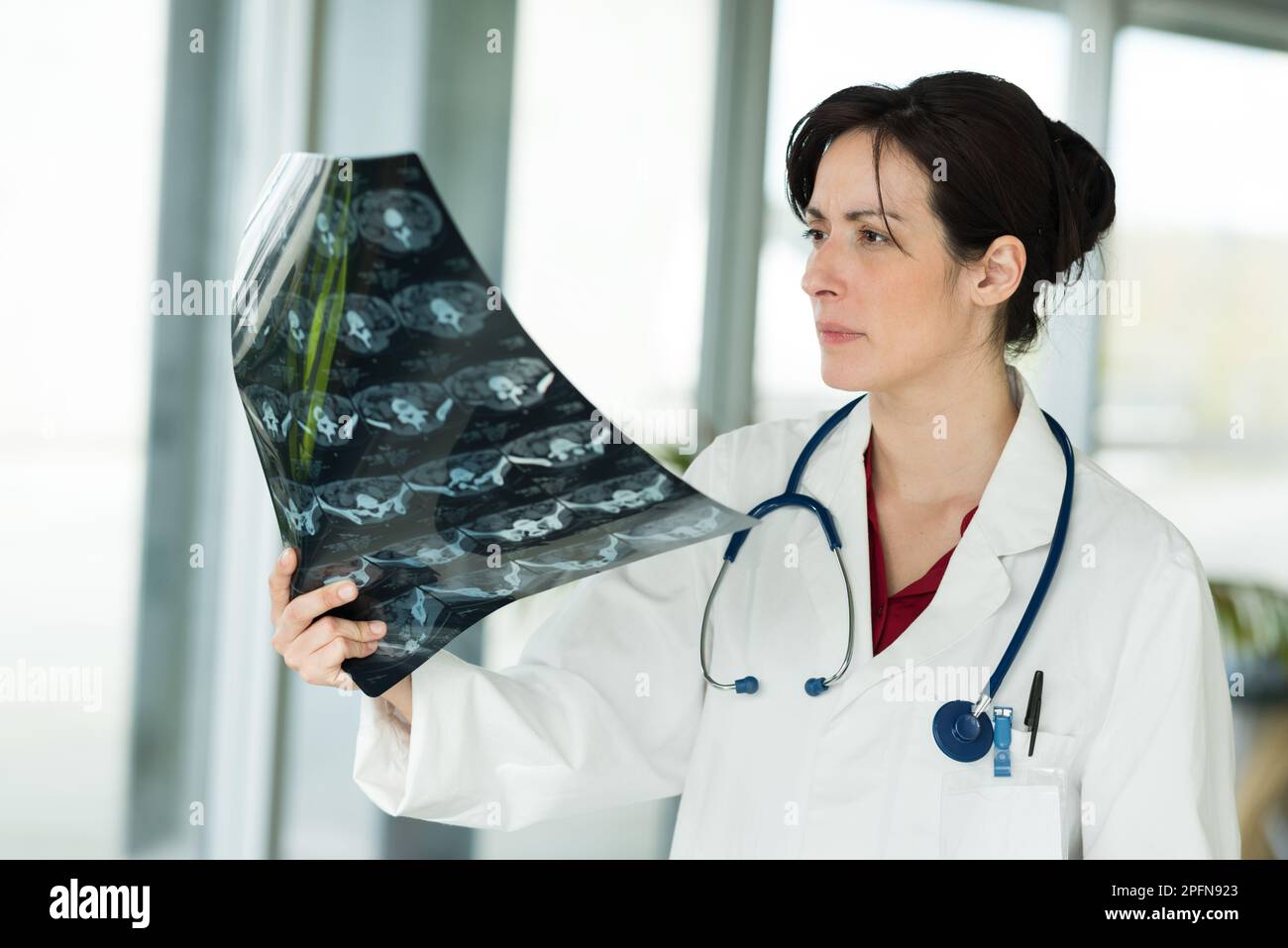 radiologist woman checking x ray Stock Photo - Alamy