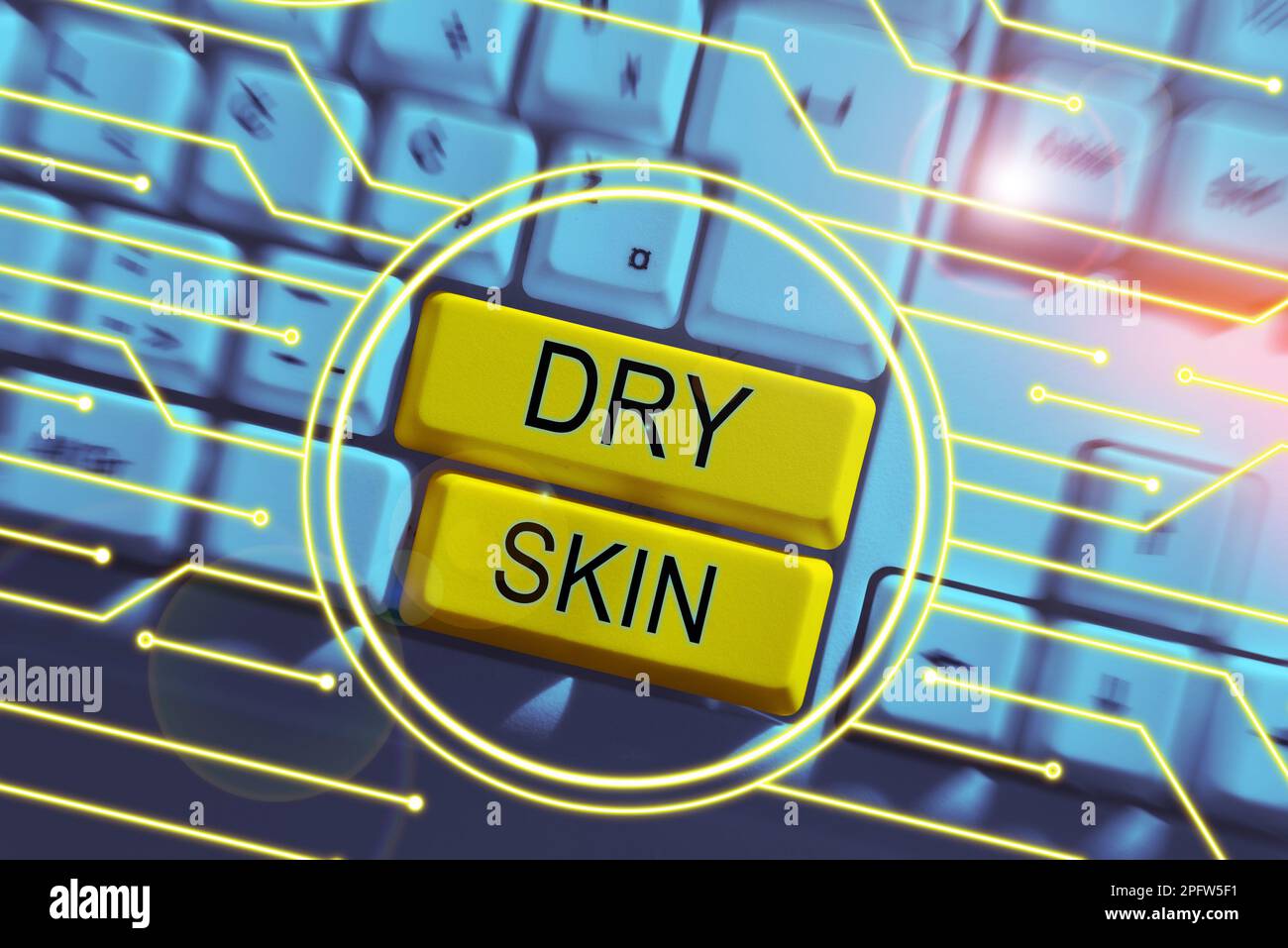 Text caption presenting Dry Skin. Conceptual photo uncomfortable ...