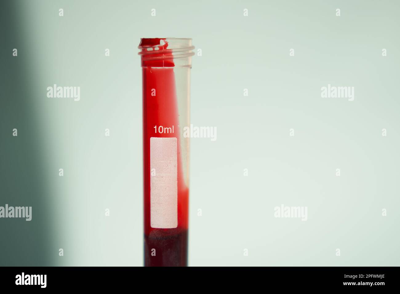 A test tube with blood on a light background. Transparent tubes with ...