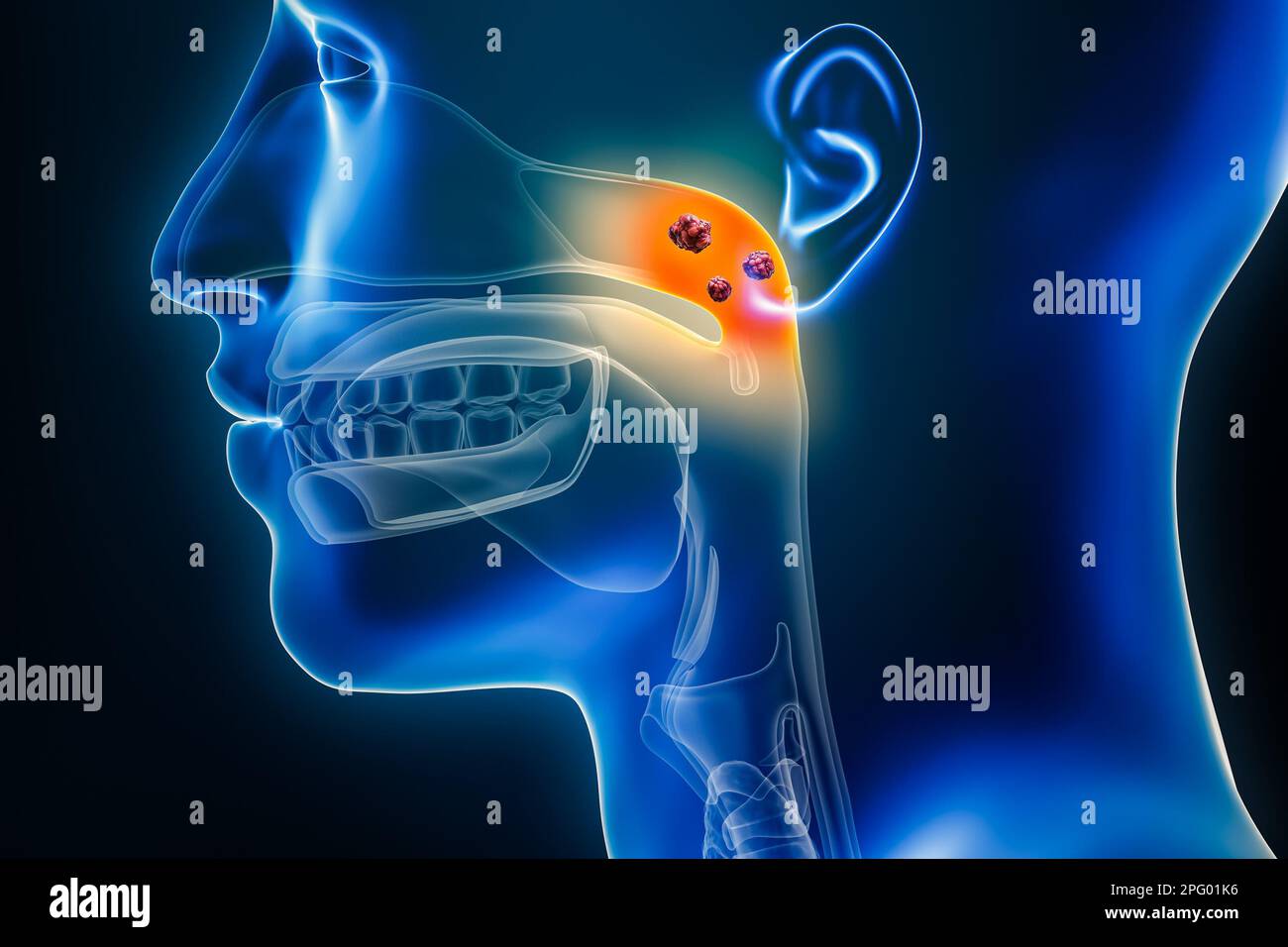 Nasopharynx hi-res stock photography and images - Alamy