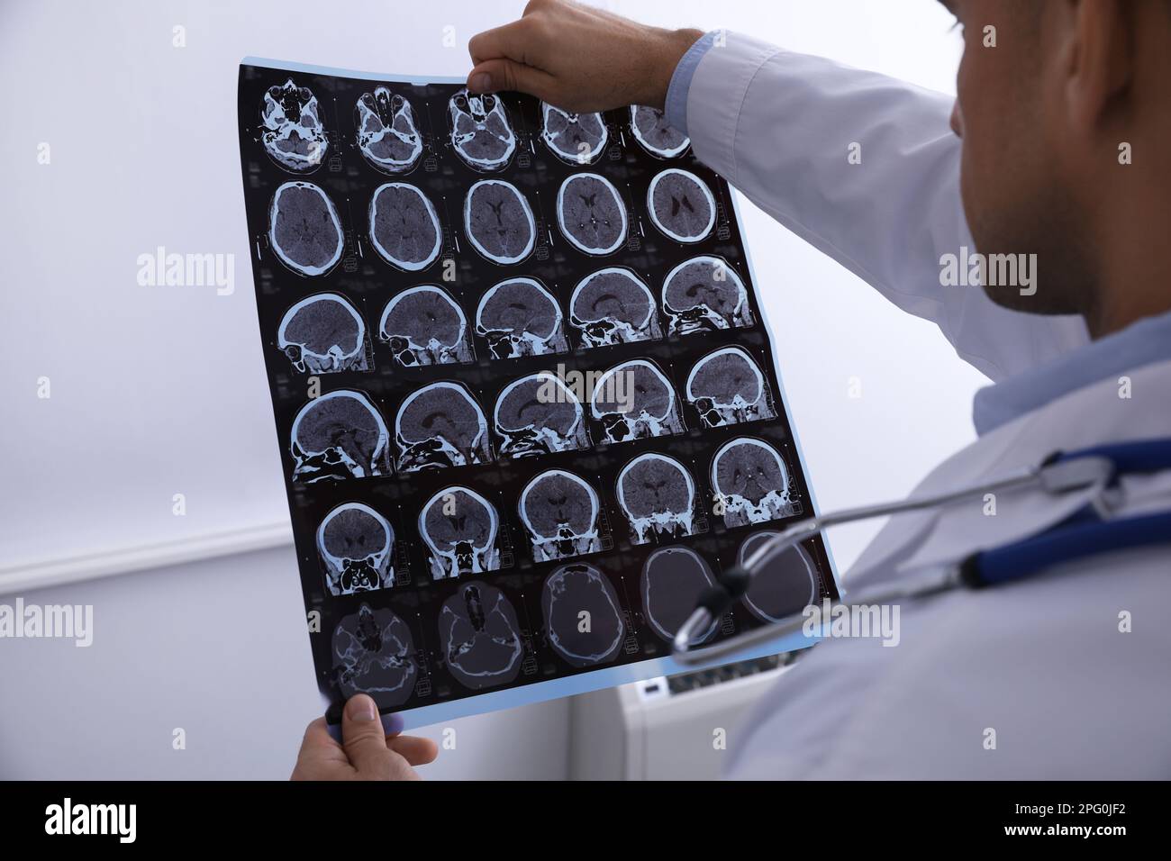 Doctor examining MRI images of patient with multiple sclerosis in ...