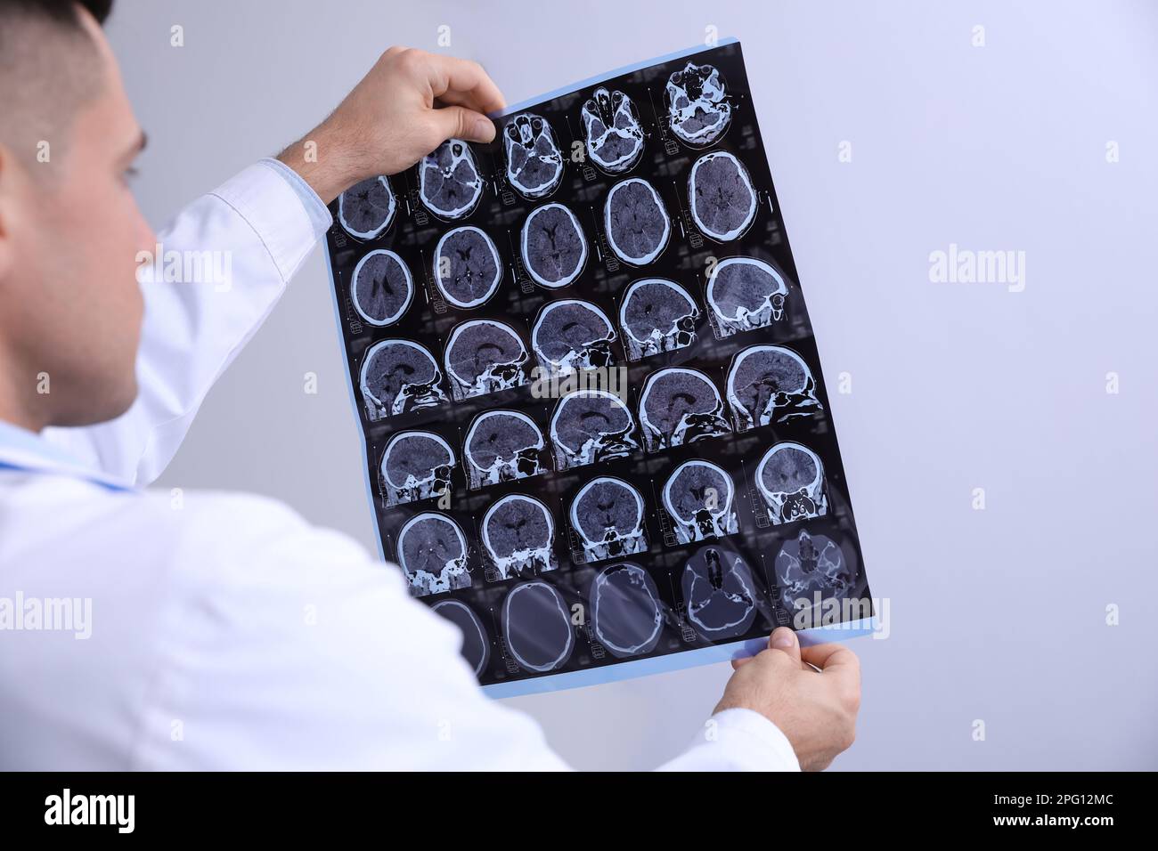 Doctor examining MRI images of patient with multiple sclerosis in ...