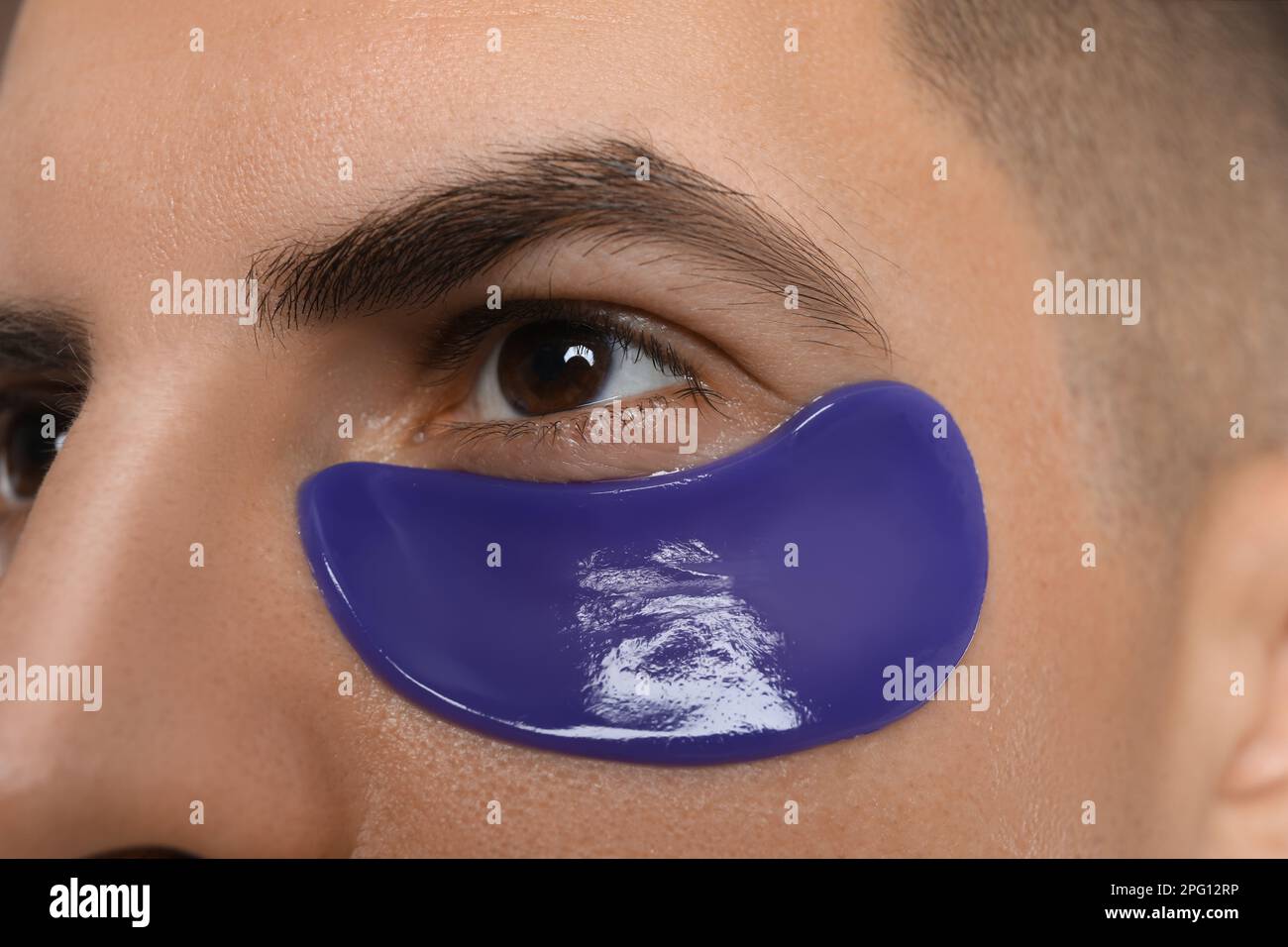 Man with blue under eye patch, closeup Stock Photo - Alamy