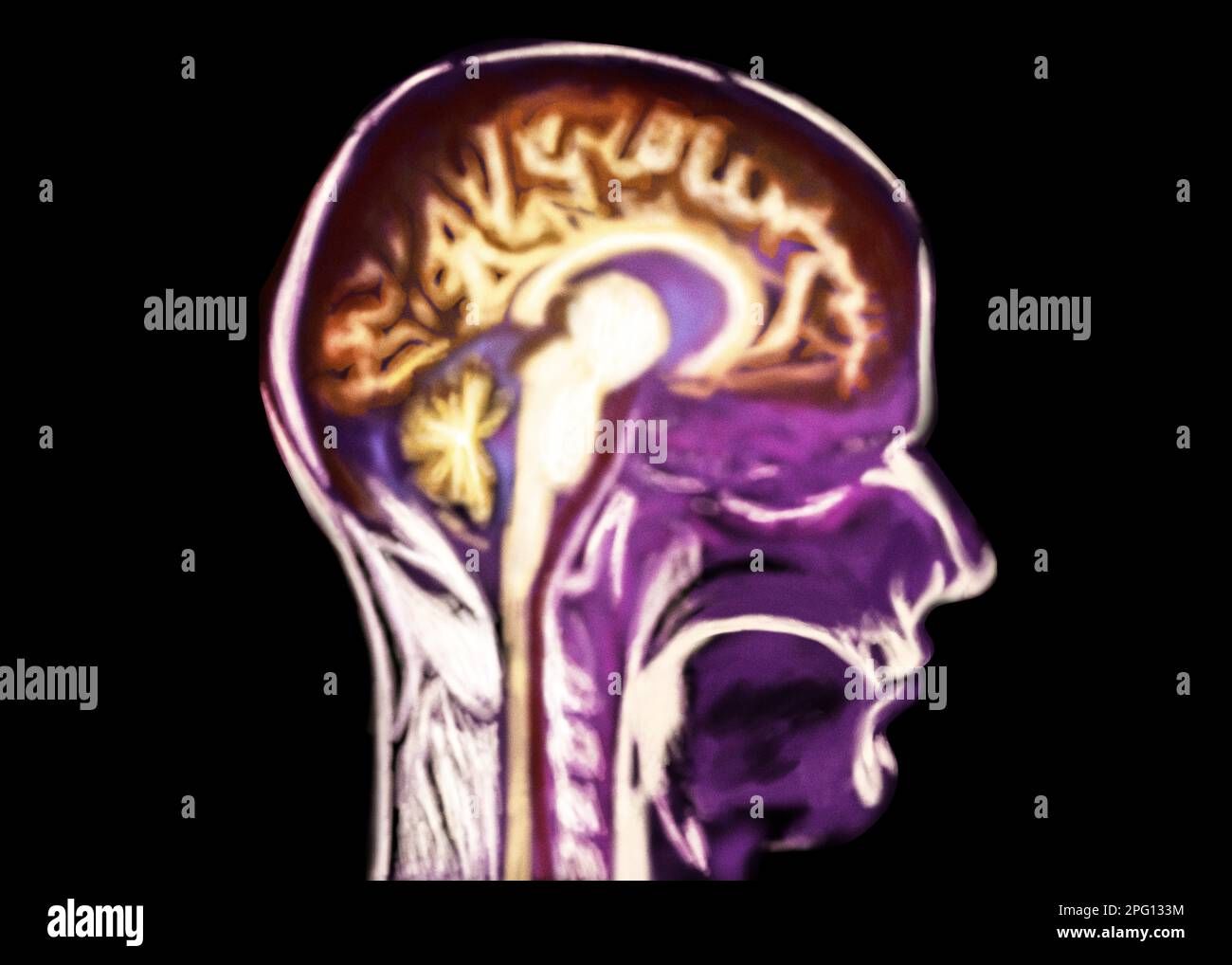 Scan of human brain area on black background, illustration Stock Photo ...