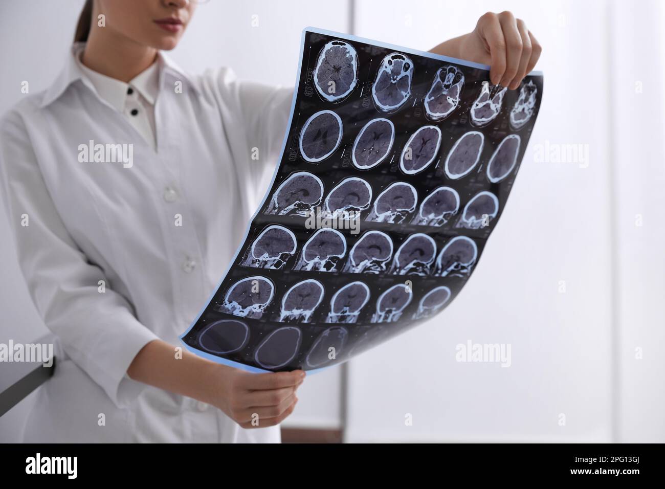 Doctor examining MRI images of patient with multiple sclerosis in ...