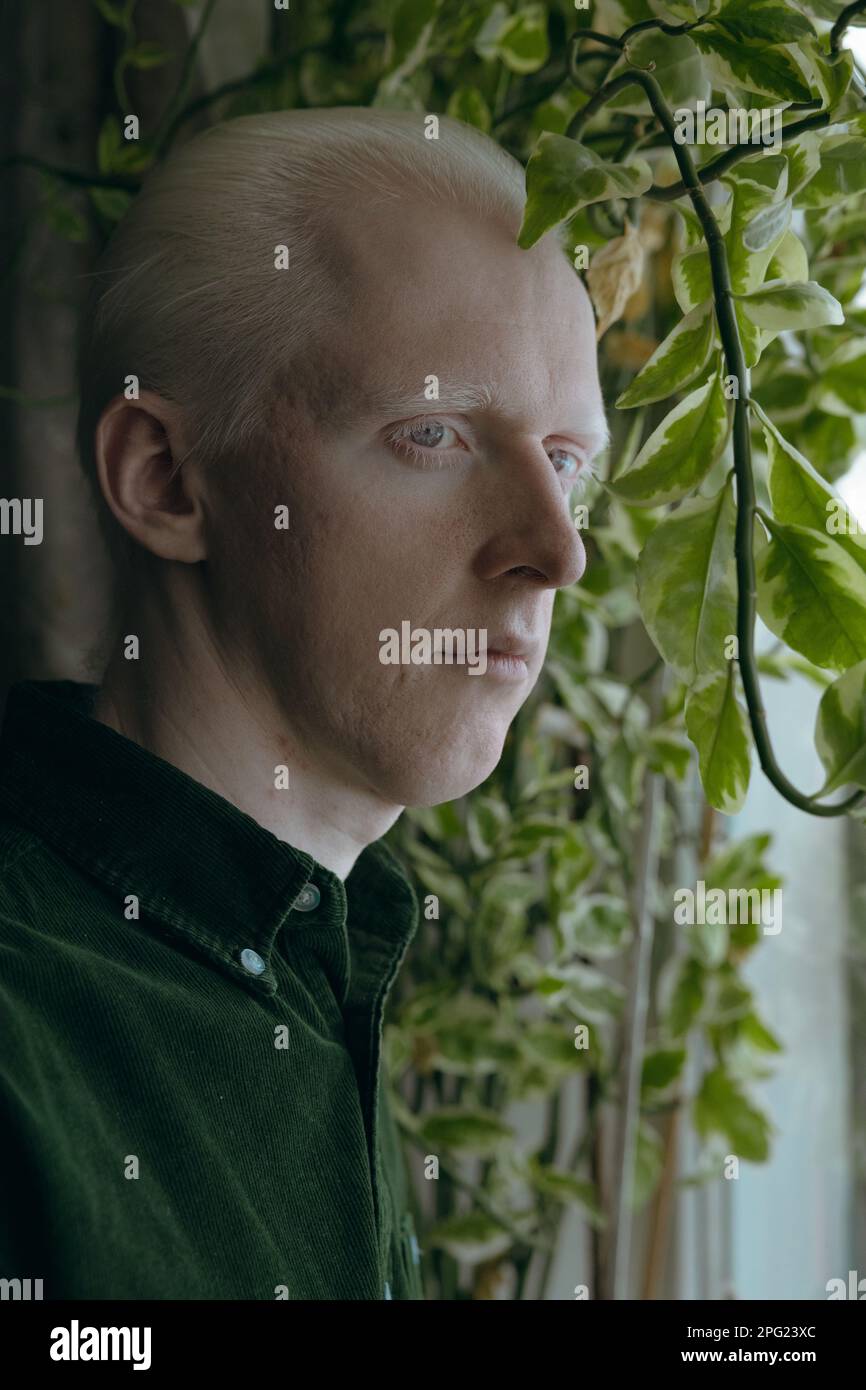 An albino guy with a green plants on a dark background Stock Photo - Alamy