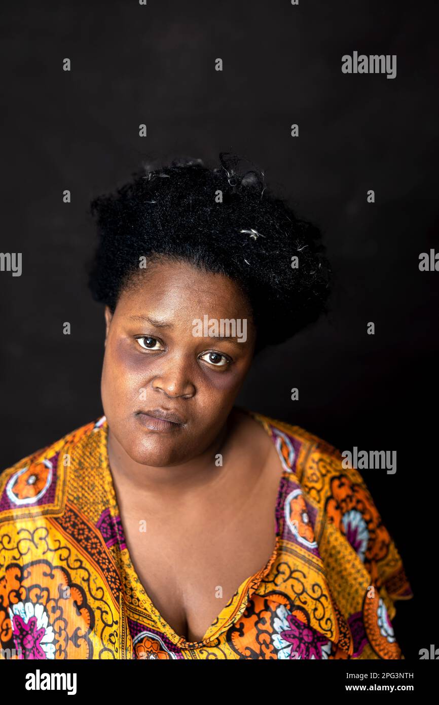 Poor South African Female Portrait Stock Photo - Alamy