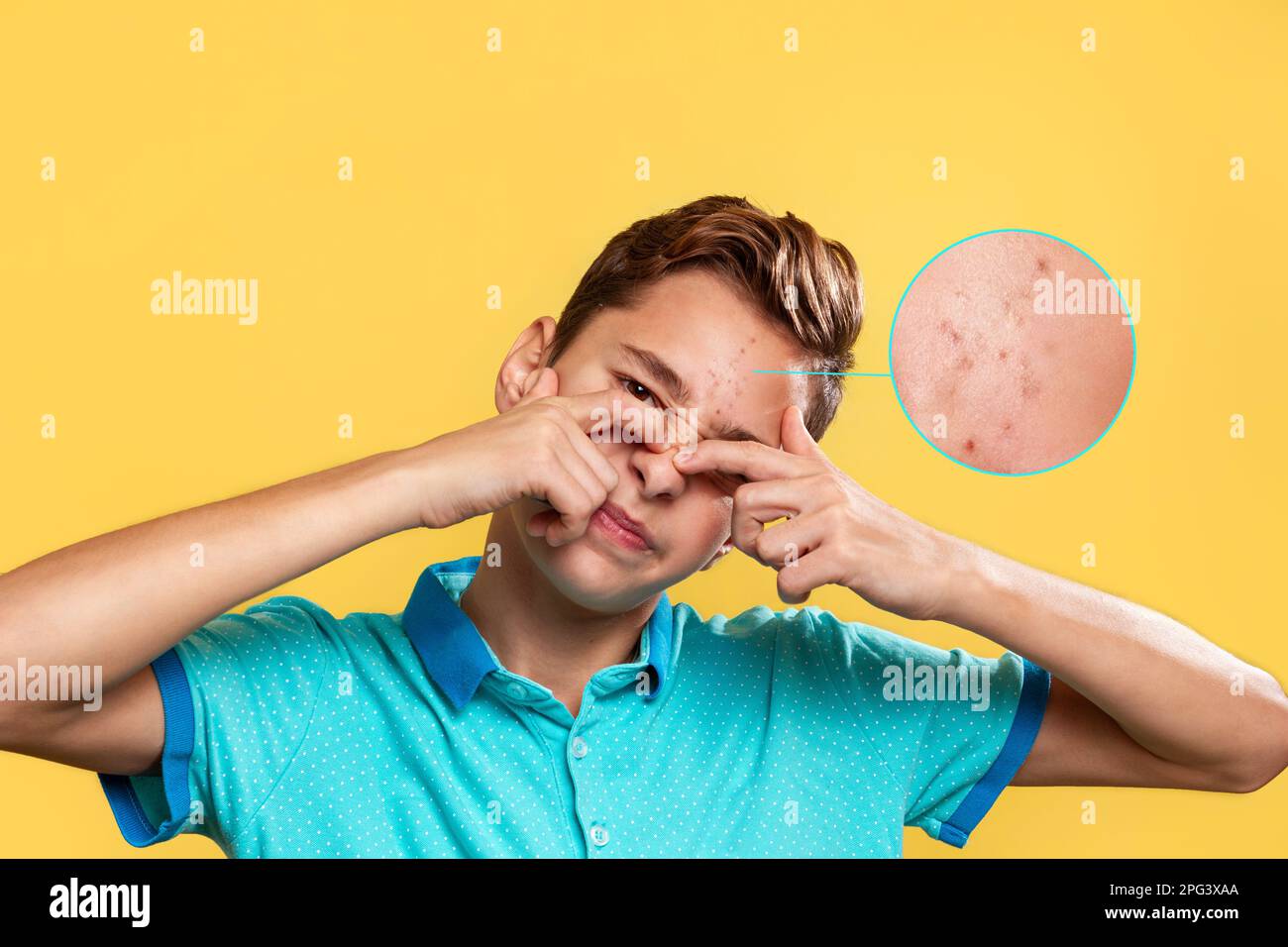 Zit circle hi-res stock photography and images - Alamy