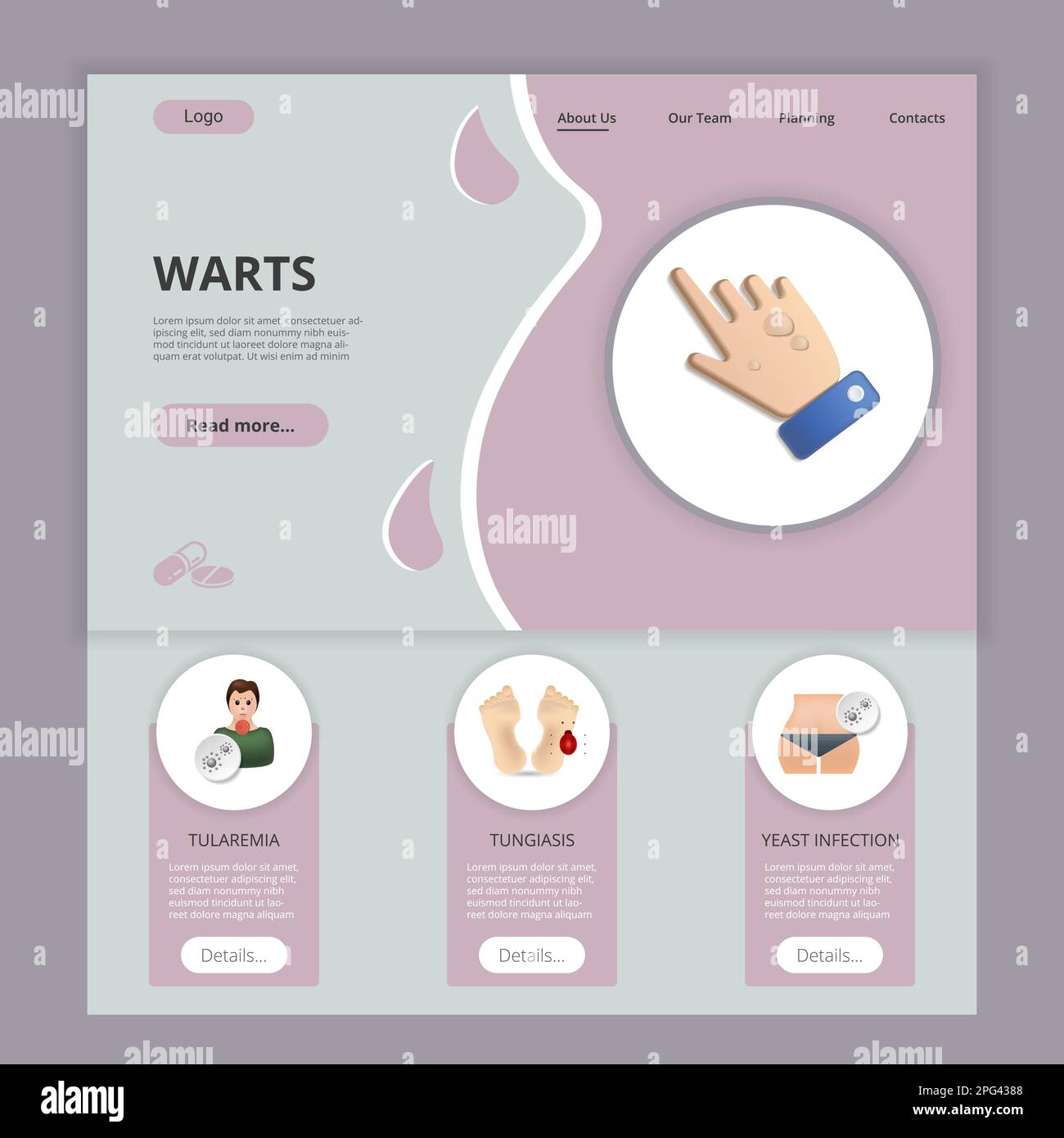 Warts flat landing page website template. Tularemia, tungiasis, yeast ...