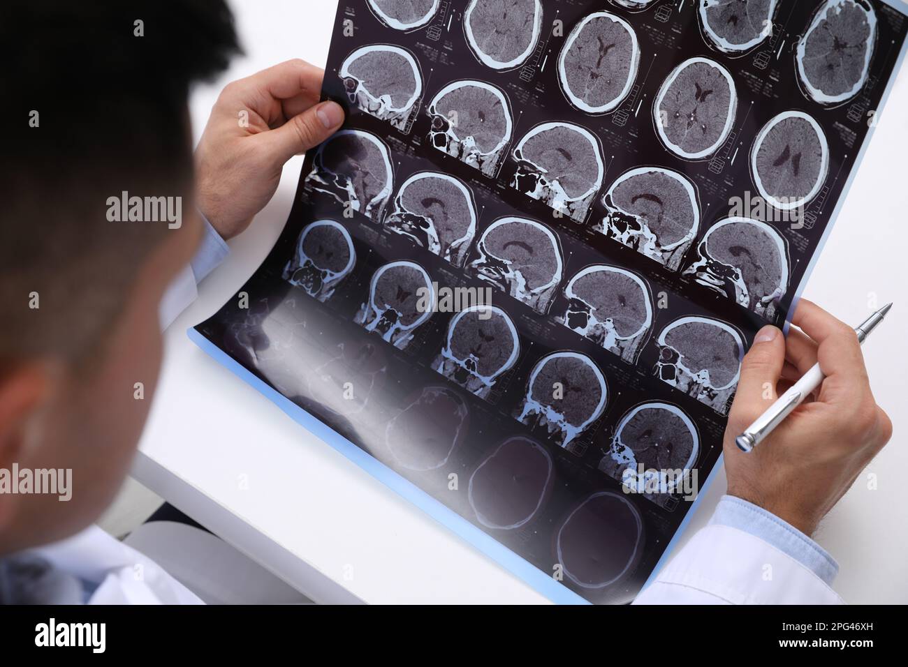 Doctor examining MRI images of patient with multiple sclerosis at white ...