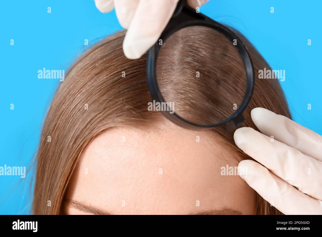 Trichologist hi-res stock photography and images - Alamy