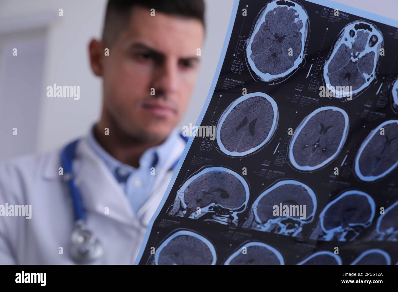 Doctor examining MRI images of patient with multiple sclerosis in ...