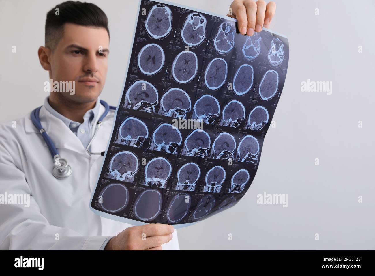 Doctor examining MRI images of patient with multiple sclerosis in ...