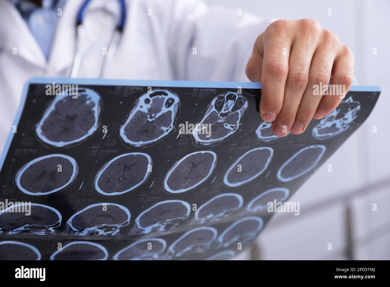 Doctor examining MRI images of patient with multiple sclerosis in ...