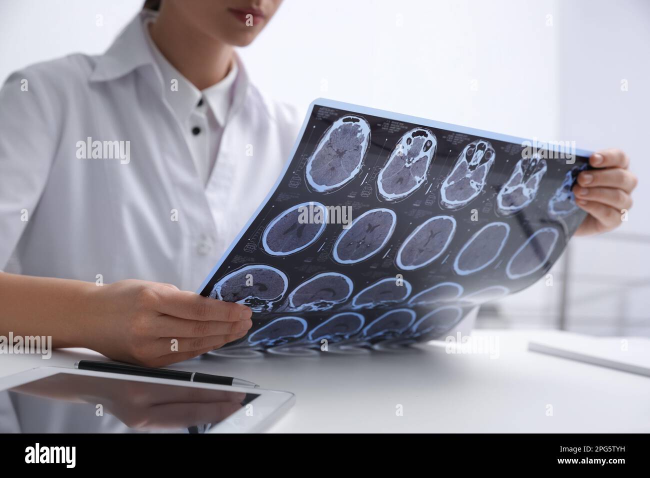 Doctor examining MRI images of patient with multiple sclerosis at table ...